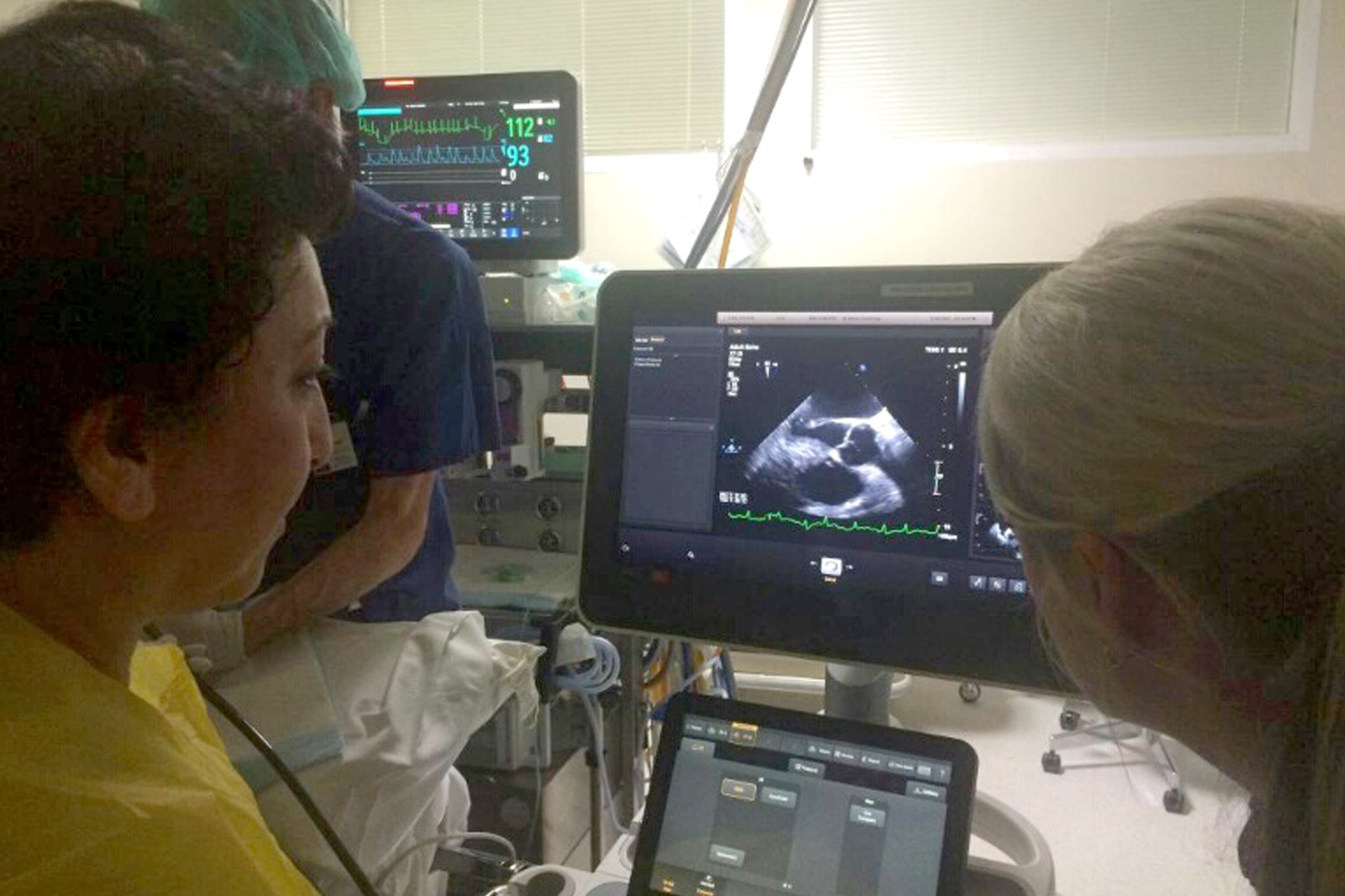 New TOE Transducer - Mildura Cardio